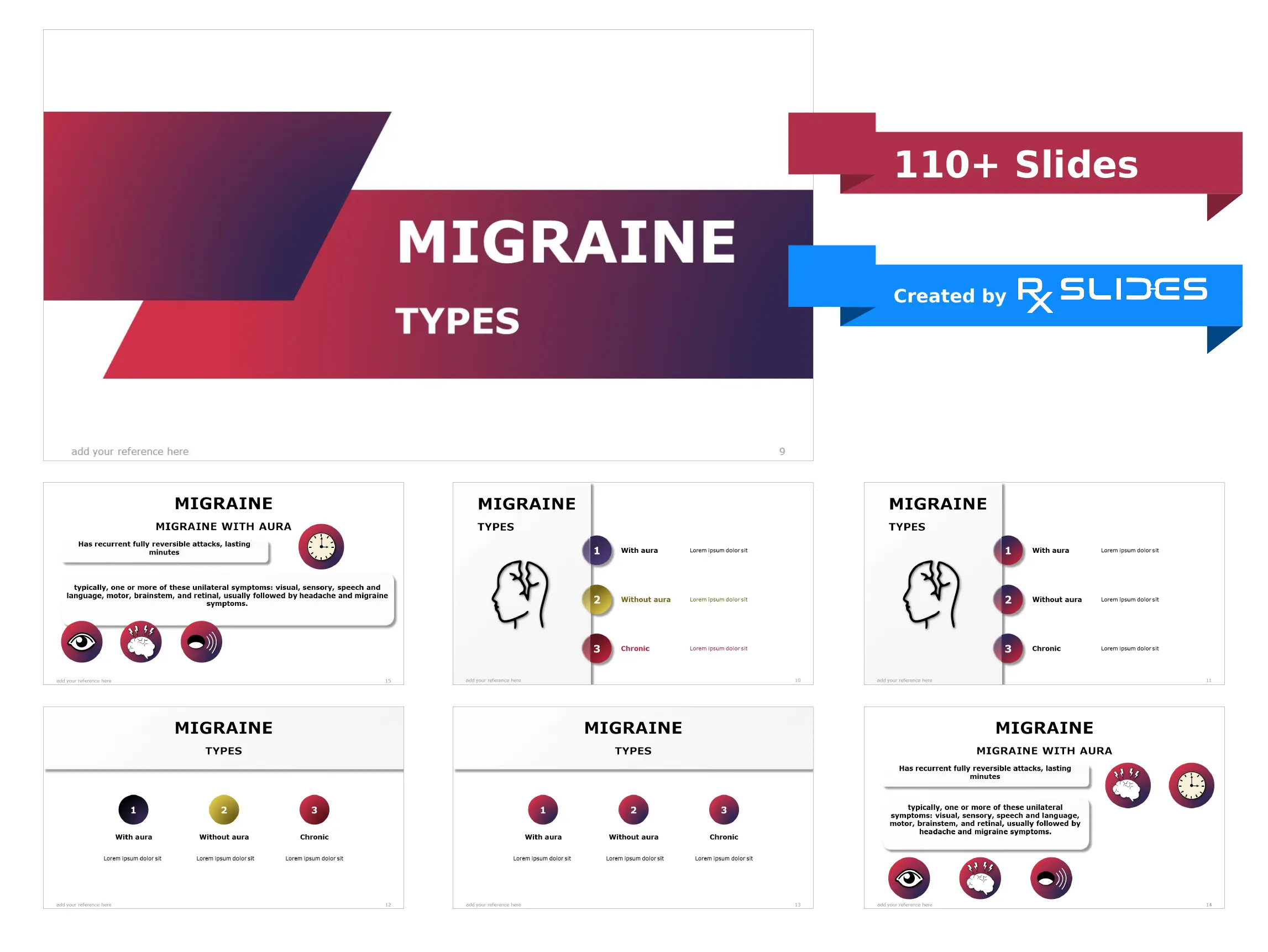 Download Migraine PowerPoint Template|RxSlides